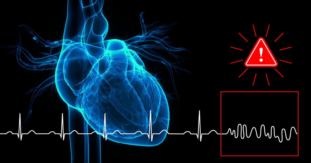 Validating The Reliability Of Ai Algorithms For Detecting Cardiac 5372