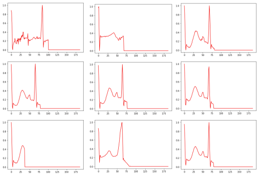 Validating The Reliability Of Ai Algorithms For Detecting Cardiac 0263