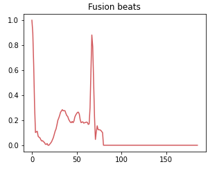 Validating the reliability of AI algorithms for detecting cardiac ...